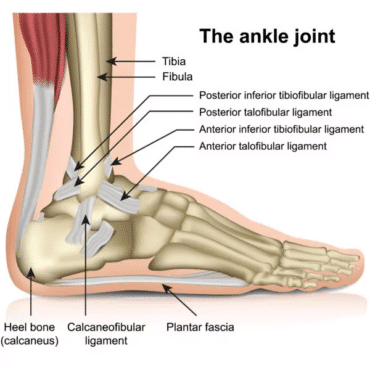 Twisted Ankle vs Sprain: How Are They Different? | Pro Foot