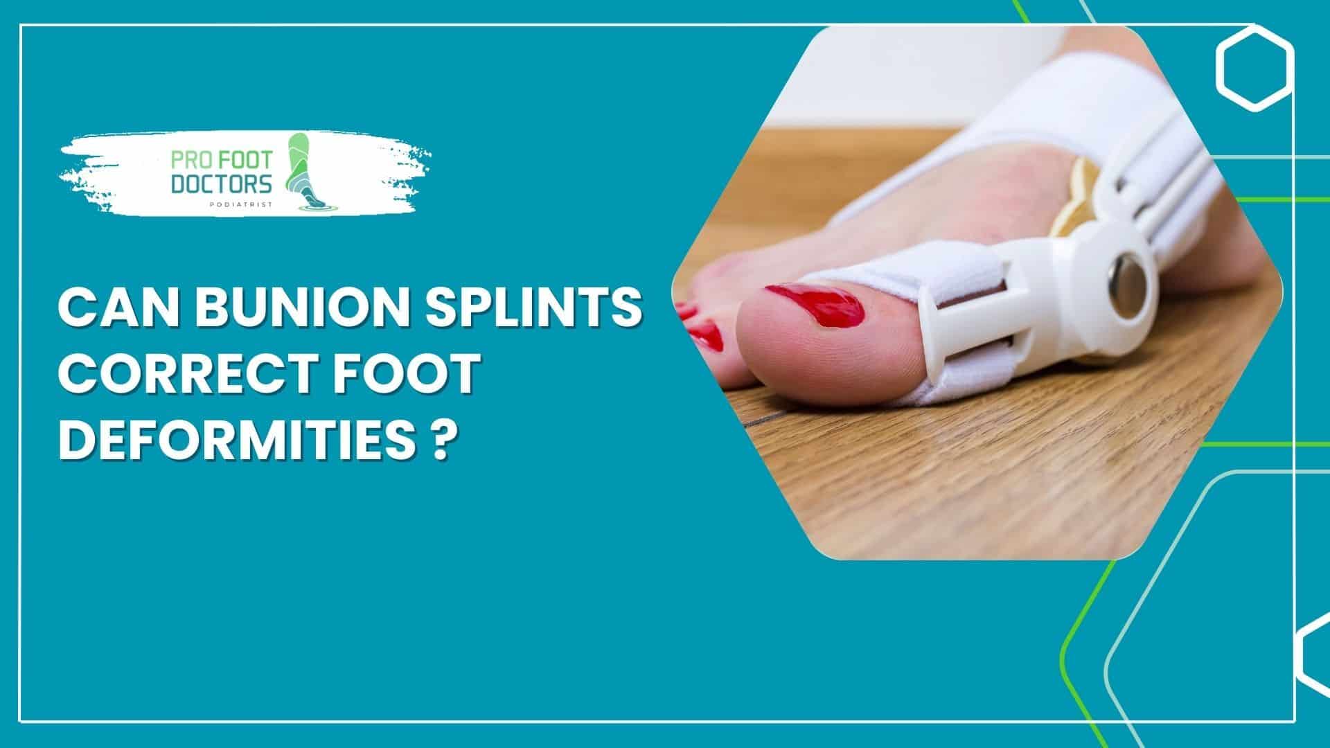 Bunion Splints Correct Foot Deformities? | Pro Foot Doctors
