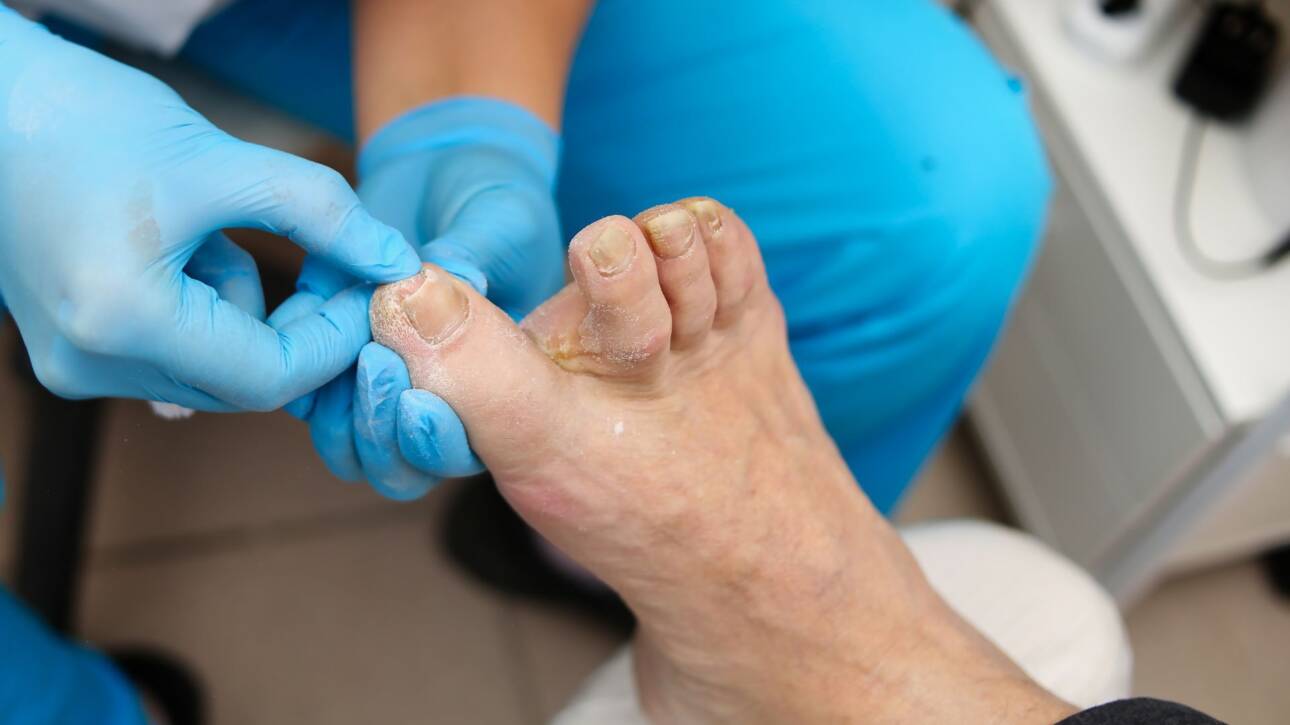 When to See a Doctor for Ingrown Toenail? Pro Foot Doctors