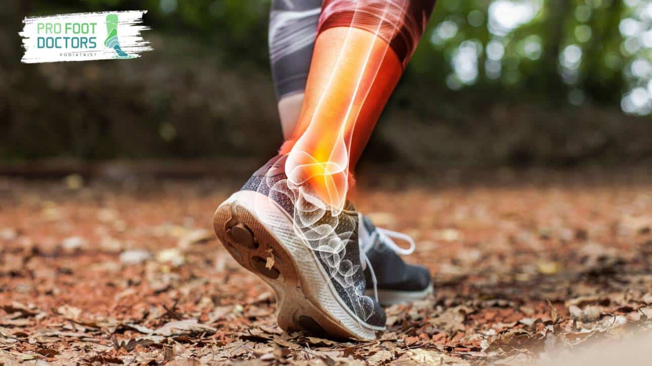 Inflammation Of The Tendons: All About Peroneal Tendonitis