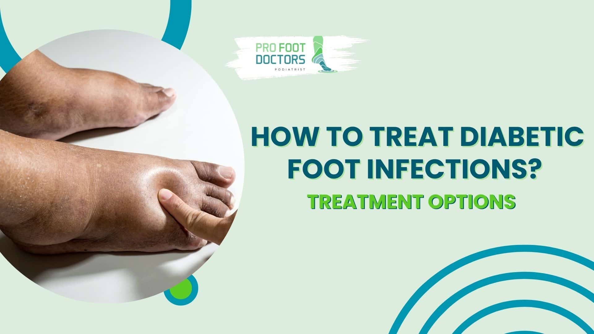 How to Treat Diabetic Foot Infections? Treatment Options