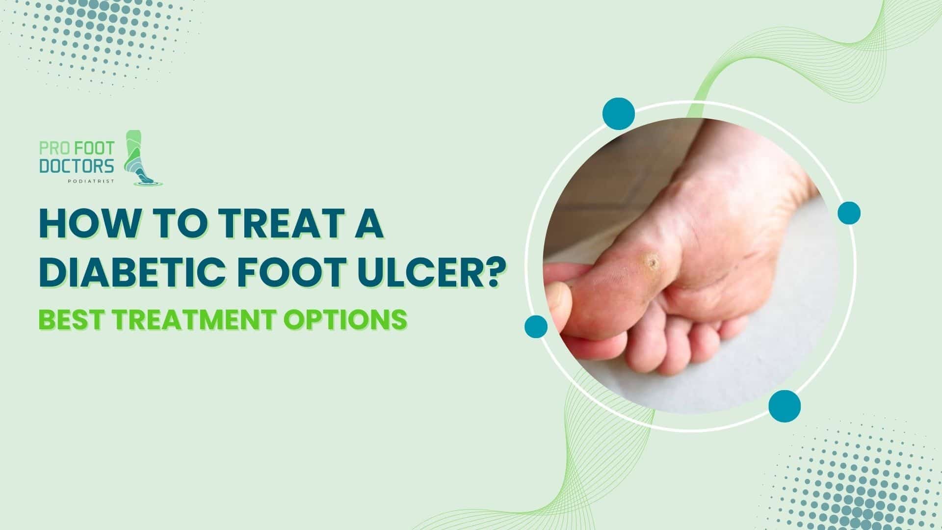 How to Treat a Diabetic Foot Ulcer? Best Treatment Options