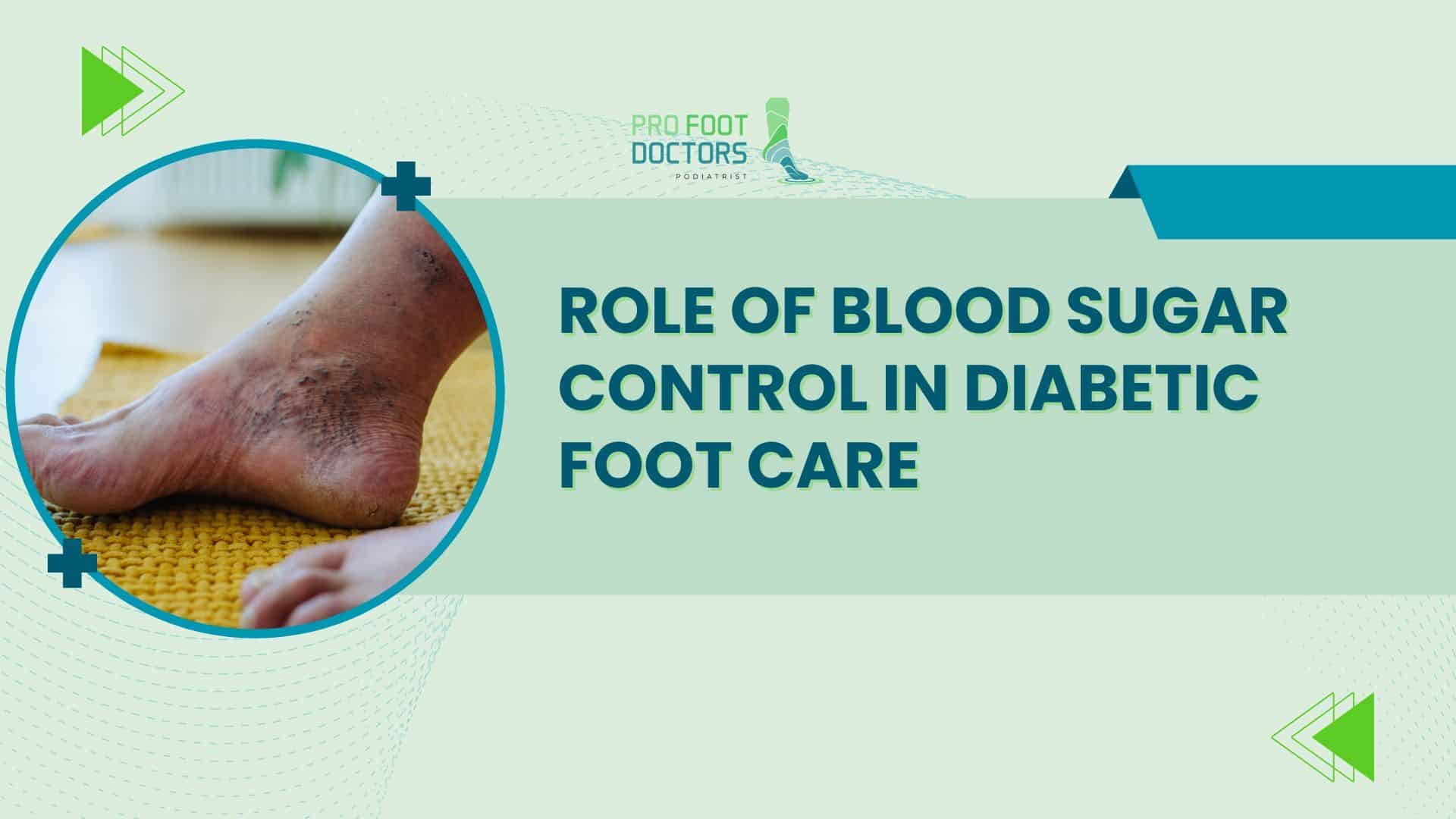 Role of Blood Sugar Control in Diabetic Foot Treatment