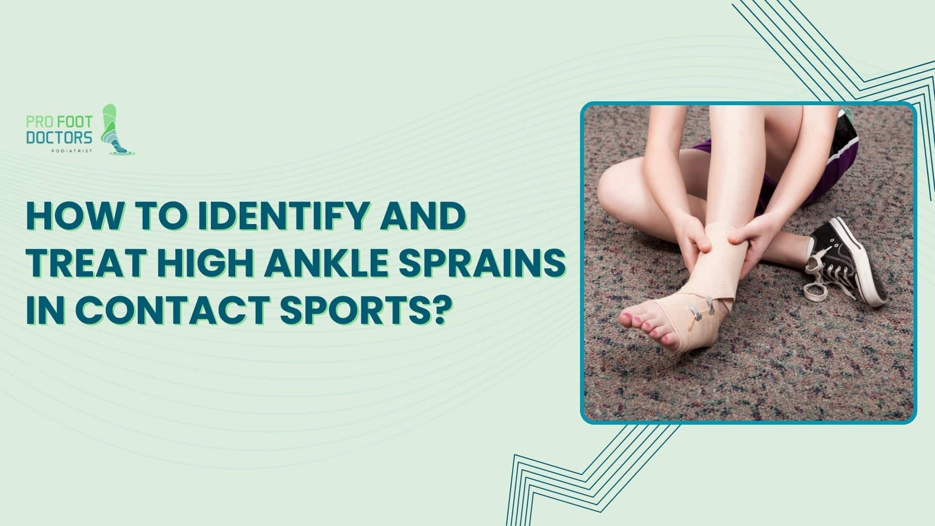 High Ankle Sprains in Contact Sports Recognized and Treated