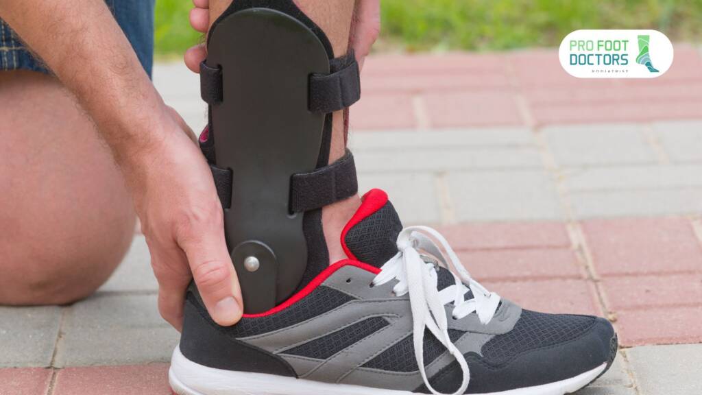 Rolled Ankle? How Do You Know It is Serious and Needs Help?